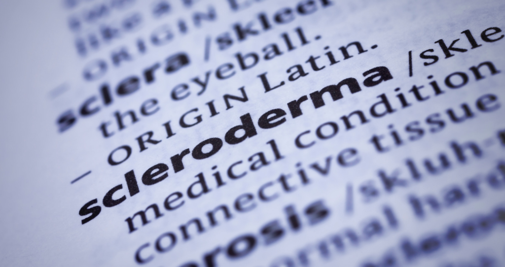 Skleroderma dan Kaitannya Dengan Hipertensi Paru - hipertensiparu.org